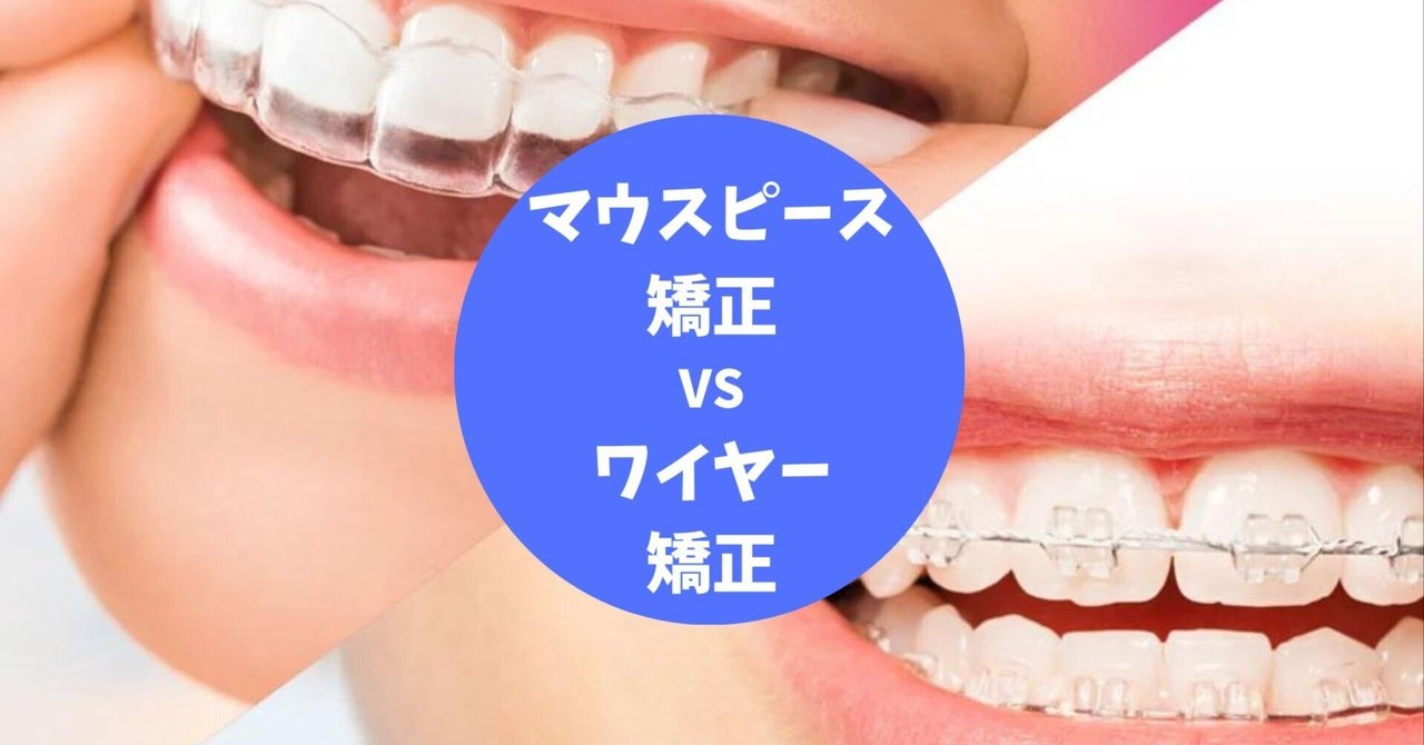 マウスピース矯正 VS ワイヤー矯正｜64ちたん@Lifehacker