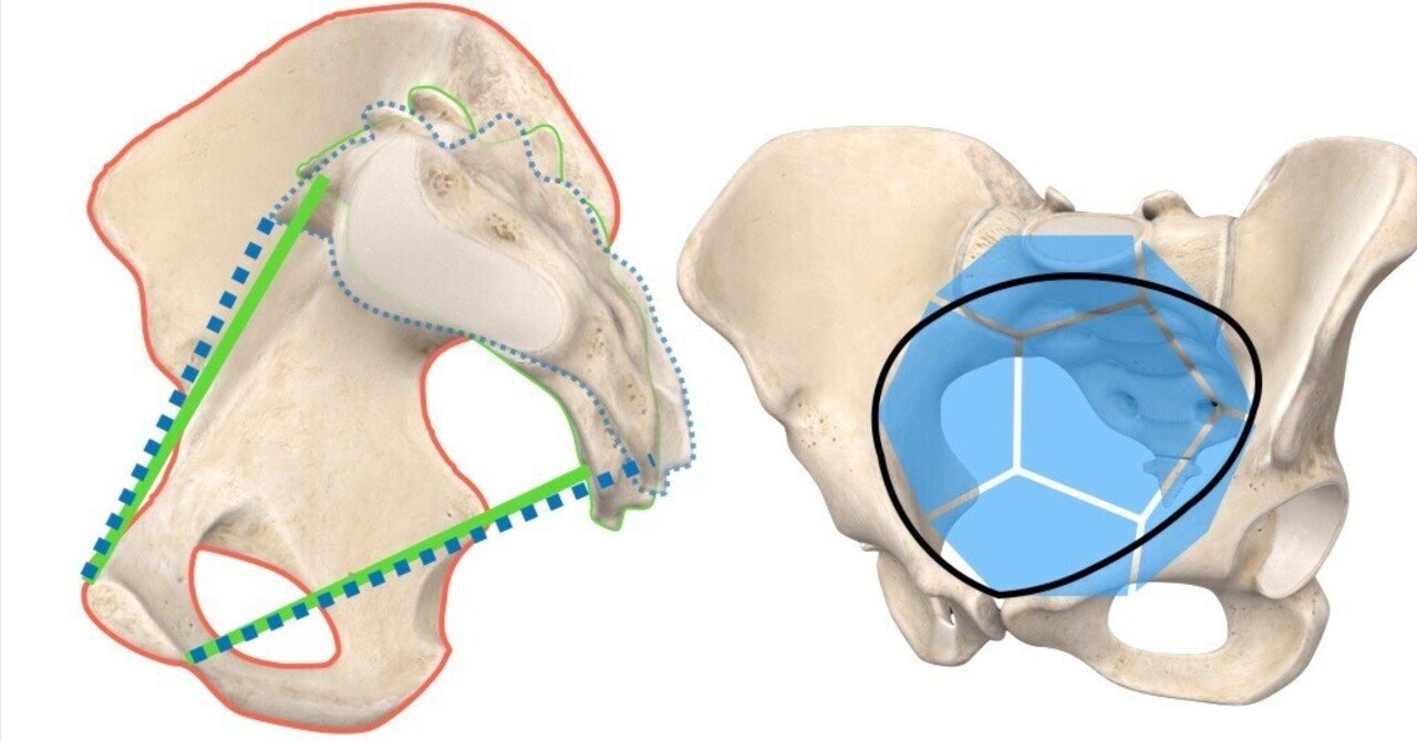 骨盤底筋トレーニングpelvic floor muscle training:PFMT｜西村 公典