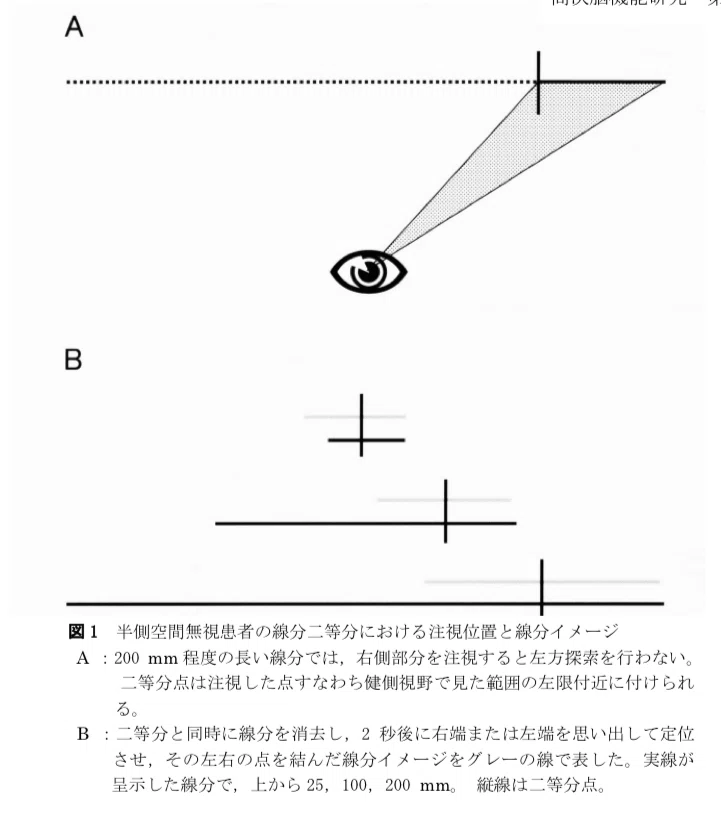 半側空間無視[BIT検査の深掘り]｜はらリハ【自費リハビリ&脳卒中専門セラピスト】