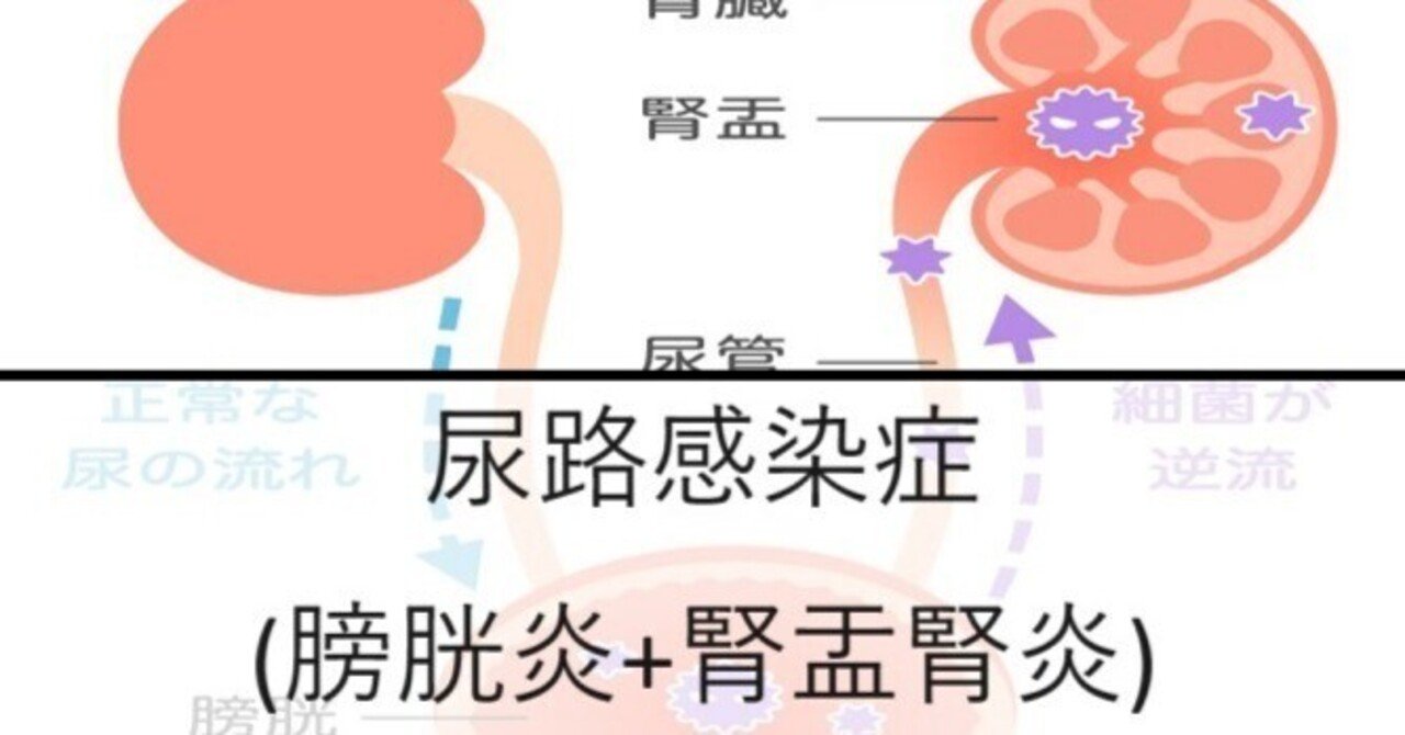 【完全公開はnoteだけ】サクッとまるわかり！尿路感染症（膀胱炎腎盂腎炎）の看護診断｜なんでなんだナーシング30