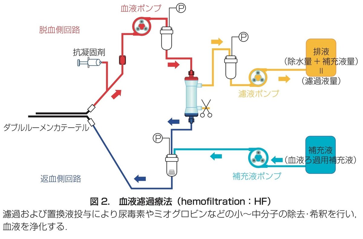 透析の基礎知識を分かる範囲でまとめてみる｜薬備（ヤクビ）〜保険薬局薬剤師のアカデミック備忘録〜鎌田貴志