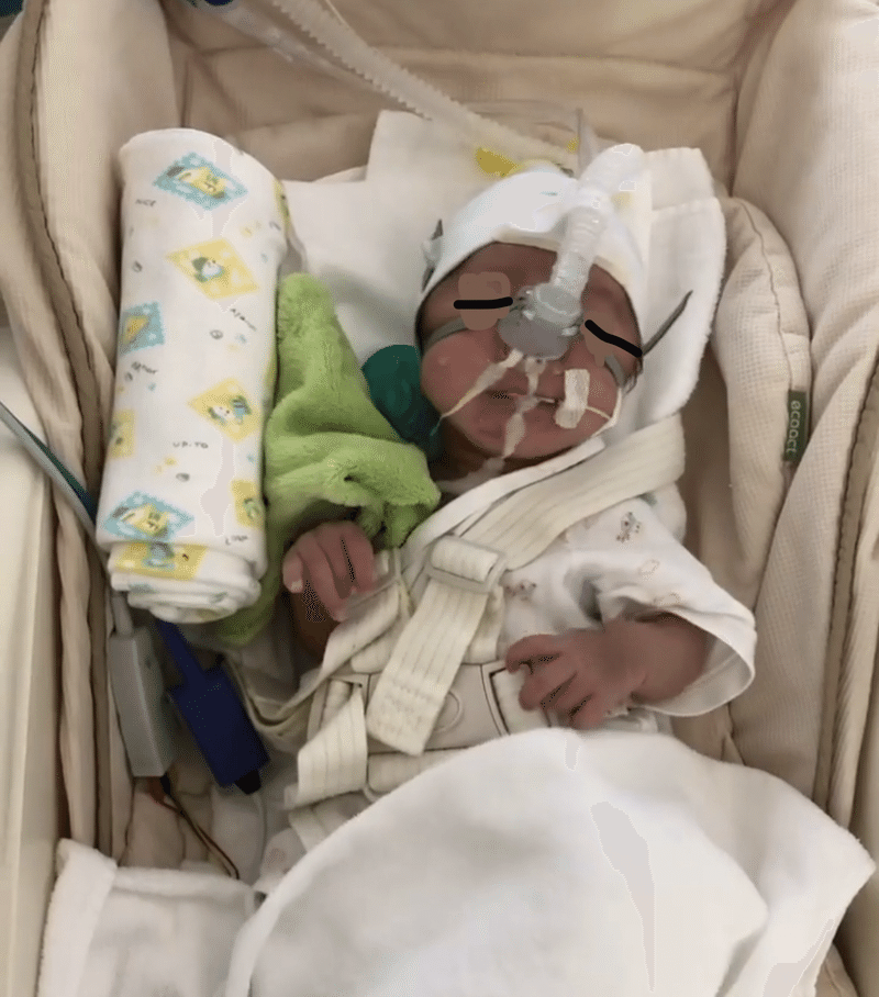 気管切開児⭐︎振り返りNICU・GCU時代の記録vol.15｜usachan2020