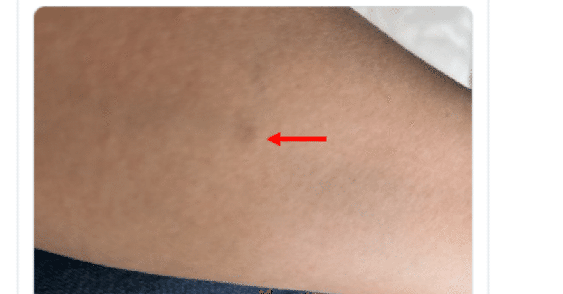 Dr Pilon (パイロン先生)｜note