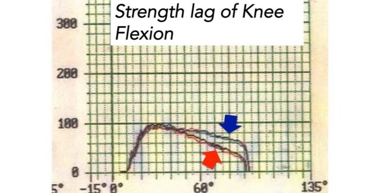 240610: ACLR・半腱様筋腱・腱採取後機能欠損・リモデリング｜Brain storm conditioning 〜 脳からコンディショニング