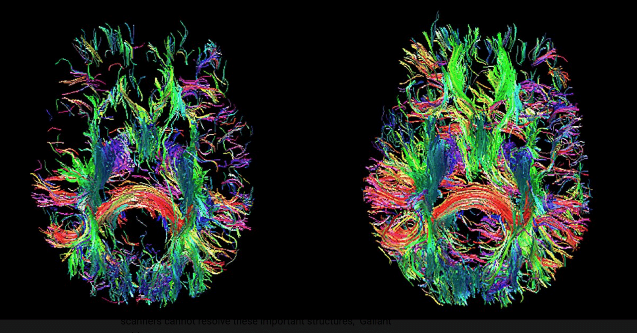 人の生きた脳の機能接続も透けて見えるfMRI｜東京 AI 研究所