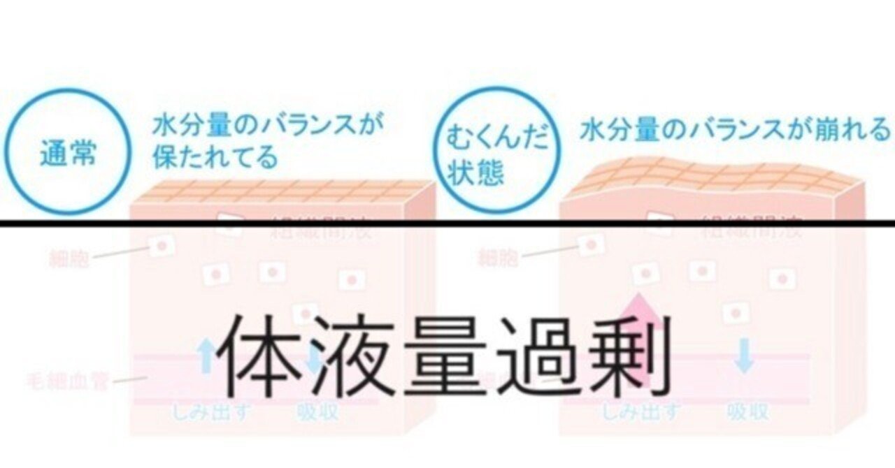 【完全公開はnoteだけ】もっと楽々コピペで立案！体液量過剰の看護計画｜なんでなんだナーシング30