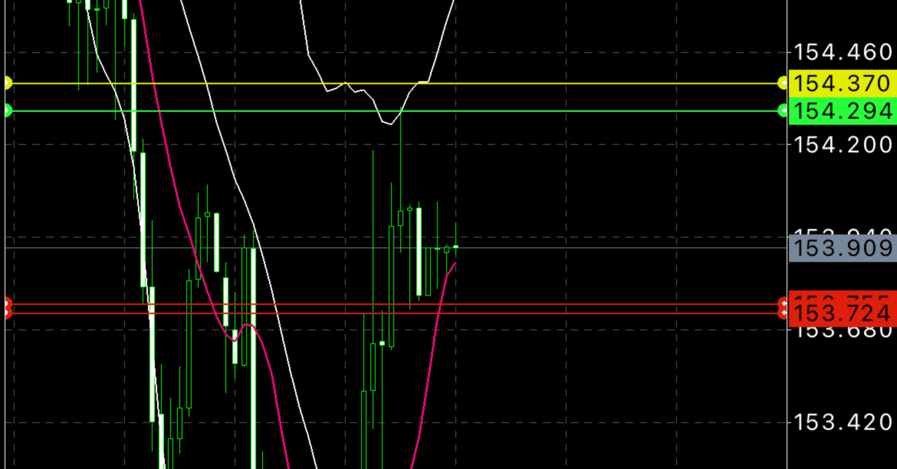 XMのメリットとデメリットを徹底解説！｜SenFXママトレーダー