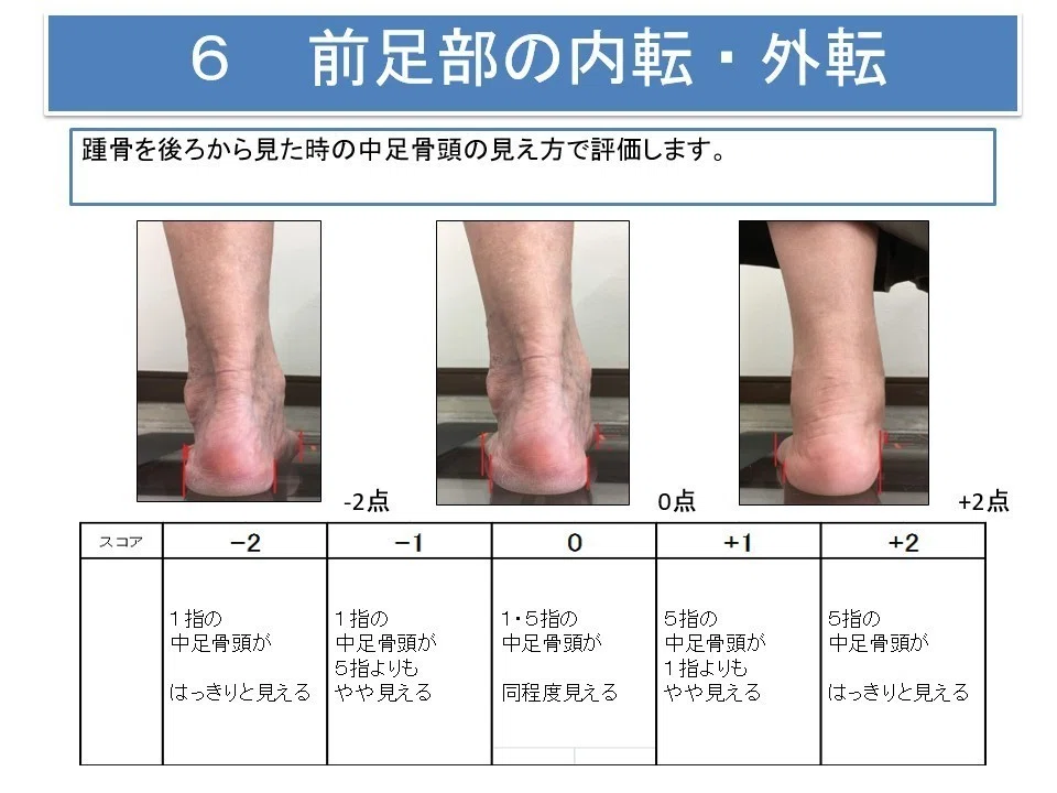 足病医伝統の 足評価術 『FPI6』簡易表｜こば｜靴屋（義肢装具士）