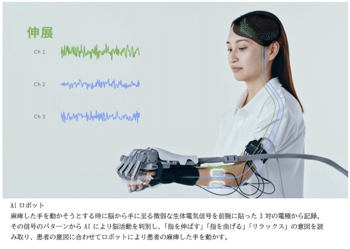 上肢・手の麻痺に対するロボットを用いたリハビリとは？｜リハビリ初学者のための日常生活応援no +e
