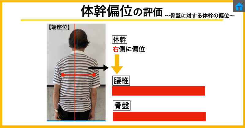 体幹偏位の評価方法｜白石哲也｜鍼灸PT📚HAMT-在宅鍼灸師のためのライブラリ-