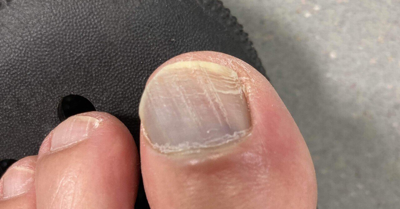 痛い😣｜chirudo12