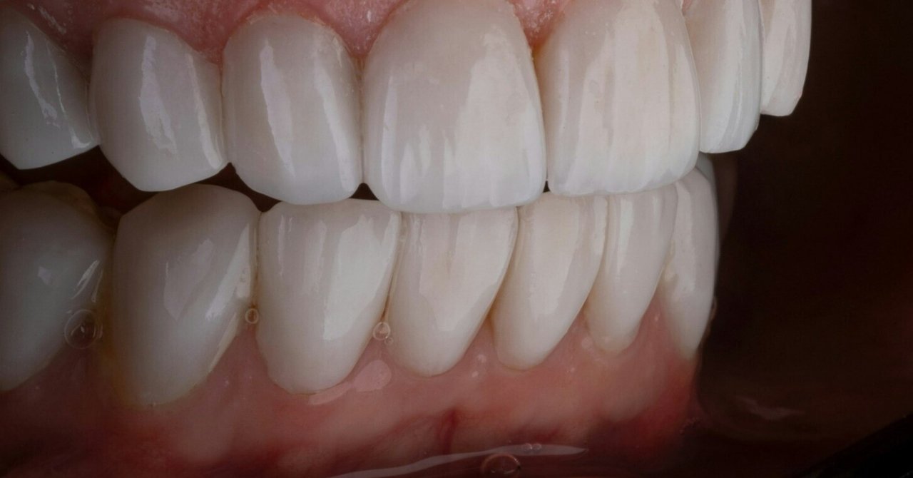 健康って何？トゥース(tooth・歯)👆!!のトゥルース(truth・真実)｜【fl-ayaka】角綾夏(すみあやか)