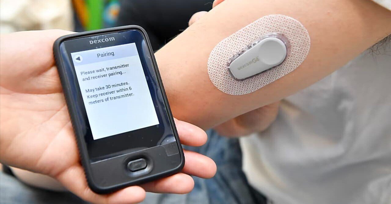 【ChatGPTによる和訳】DexCom (DXCM) Q4 2024 Earnings Call Transcript｜SG@ChatGPTで米国株決算翻訳