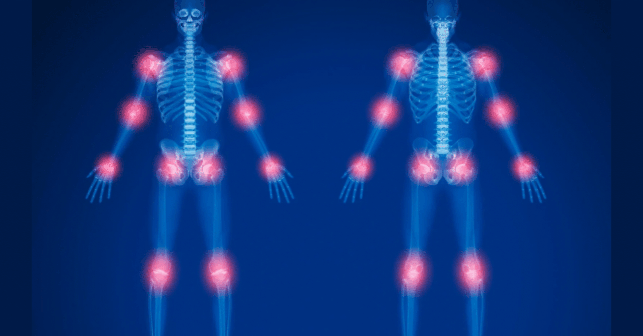 最新｜これらのビタミンサプリメントは関節炎の痛みを伴う炎症を調節します｜Hirokazu