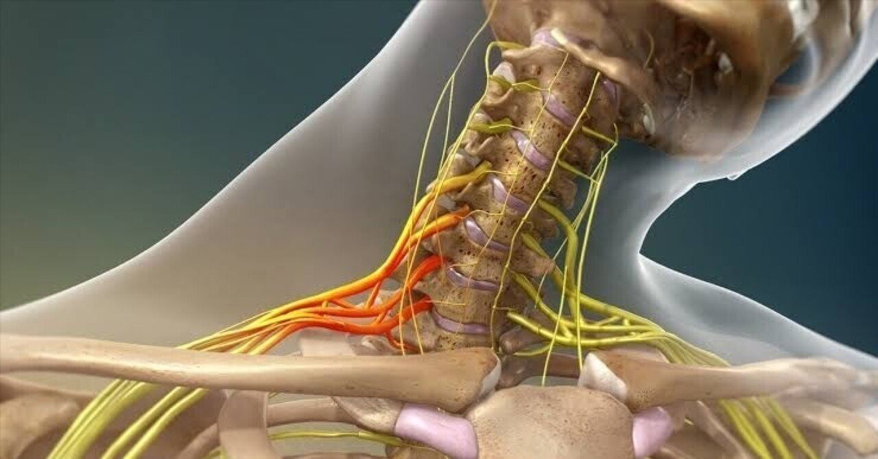 バーナー症候群（Burner Syndrome）とは？｜nakaba_ueno