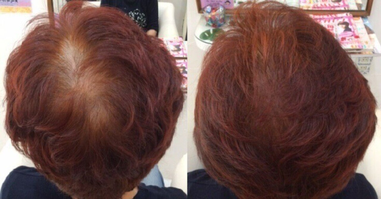 あなたの髪本来の毛流れと生え癖を丁寧に整える特別な技術｜lily_rina