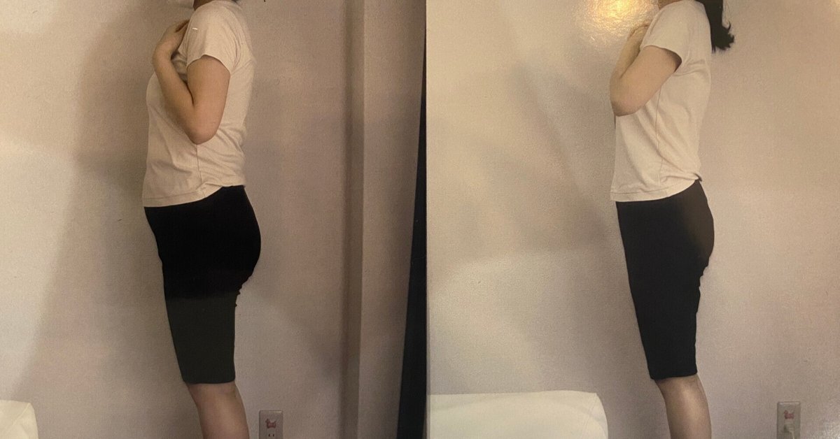 【産後21kg減量】妊娠で＋20kg。運動ゼロ人間だった私が“元より痩せた”話｜こんぷれっくすちゃん