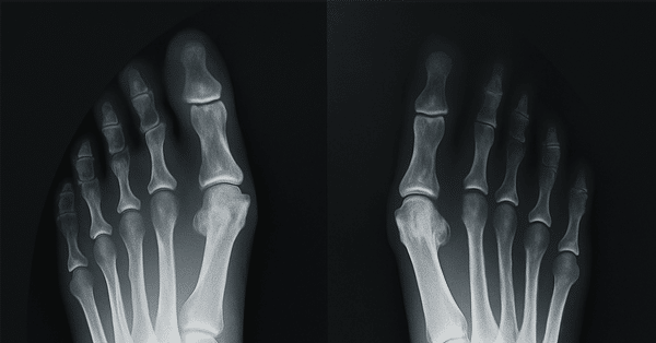 筋肉チューニング&身体操作 - ワラーチ｜續池均（kintsuzuike）@MTR Method Lab®︎｜note