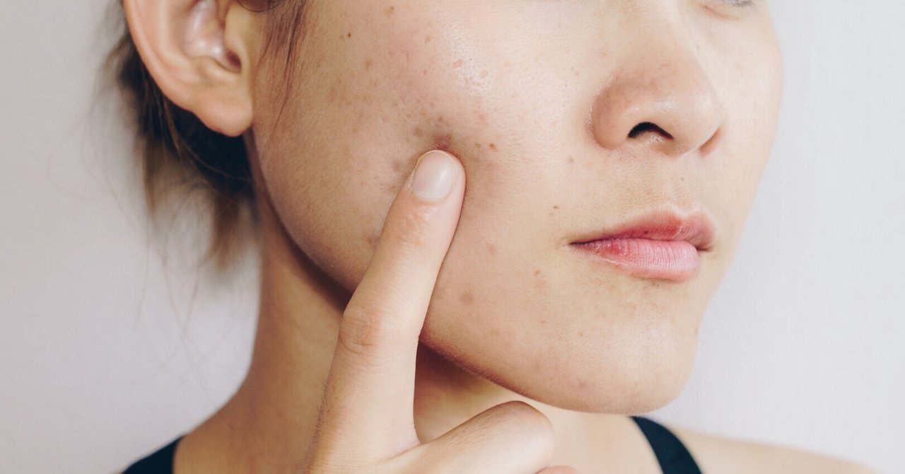 肌の常在菌とわたしたち 〜美肌のカギは“共生”にある〜｜株式会社REJI広報室 スキンケアブランド【ATELO】公式note