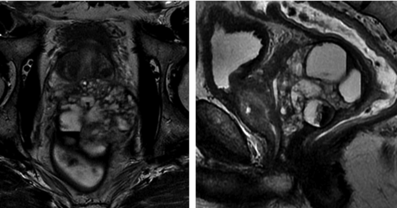 Case 297｜Toshihiro Furuta