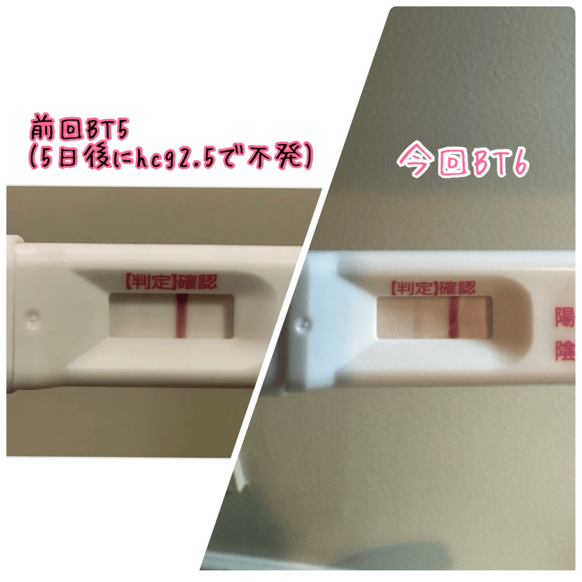 【KLC凍結胚移植】判定日前日フライング写真公開！前回不発のBT5, BT9と、今回のBT6フライングの検査薬結果写真📸｜Fire | 38歳1年の不妊治療を経て妊娠。現在妊娠6ヶ月