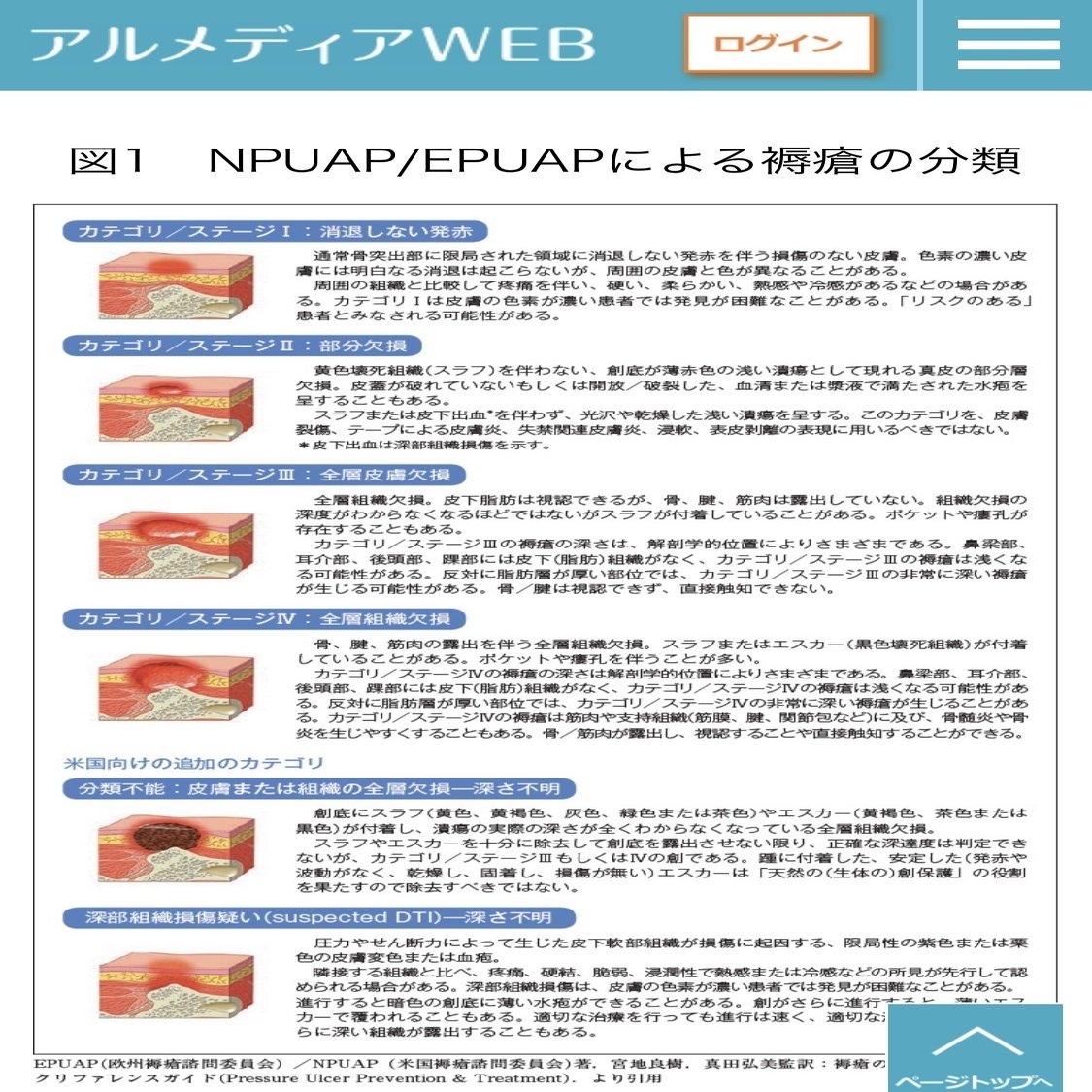 褥瘡ステージ 3