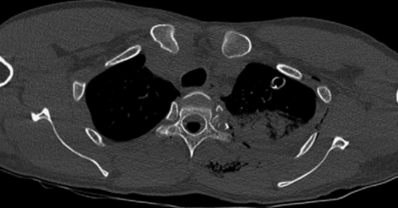 Case 301｜Toshihiro Furuta
