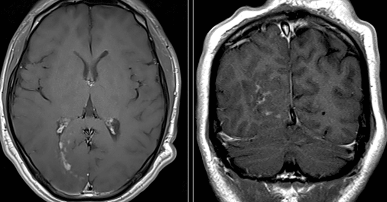 Case 302｜Toshihiro Furuta