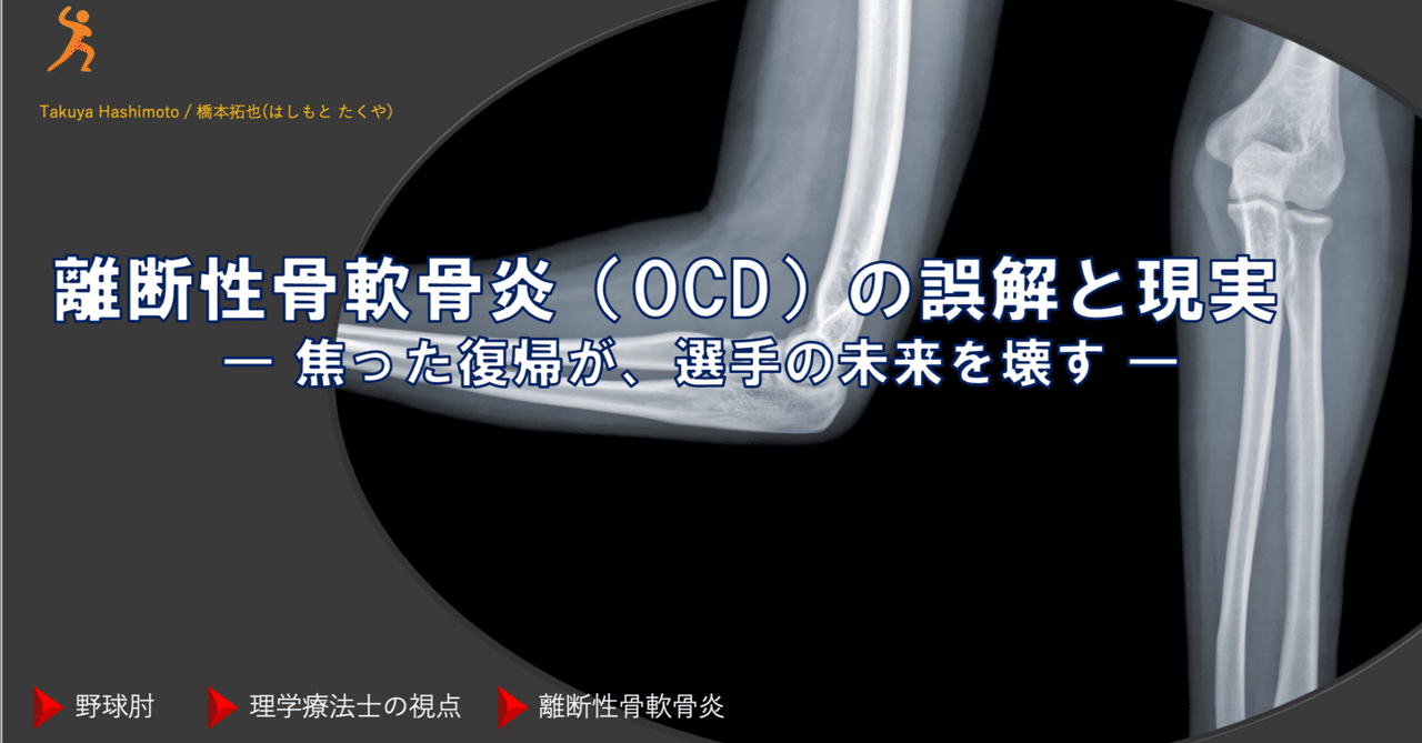 『保護者・指導者』必見！ 離断性骨軟骨炎（OCD）の誤解と現実 ｜Takuya Hashimoto (スポーツと医学の架け橋へ)