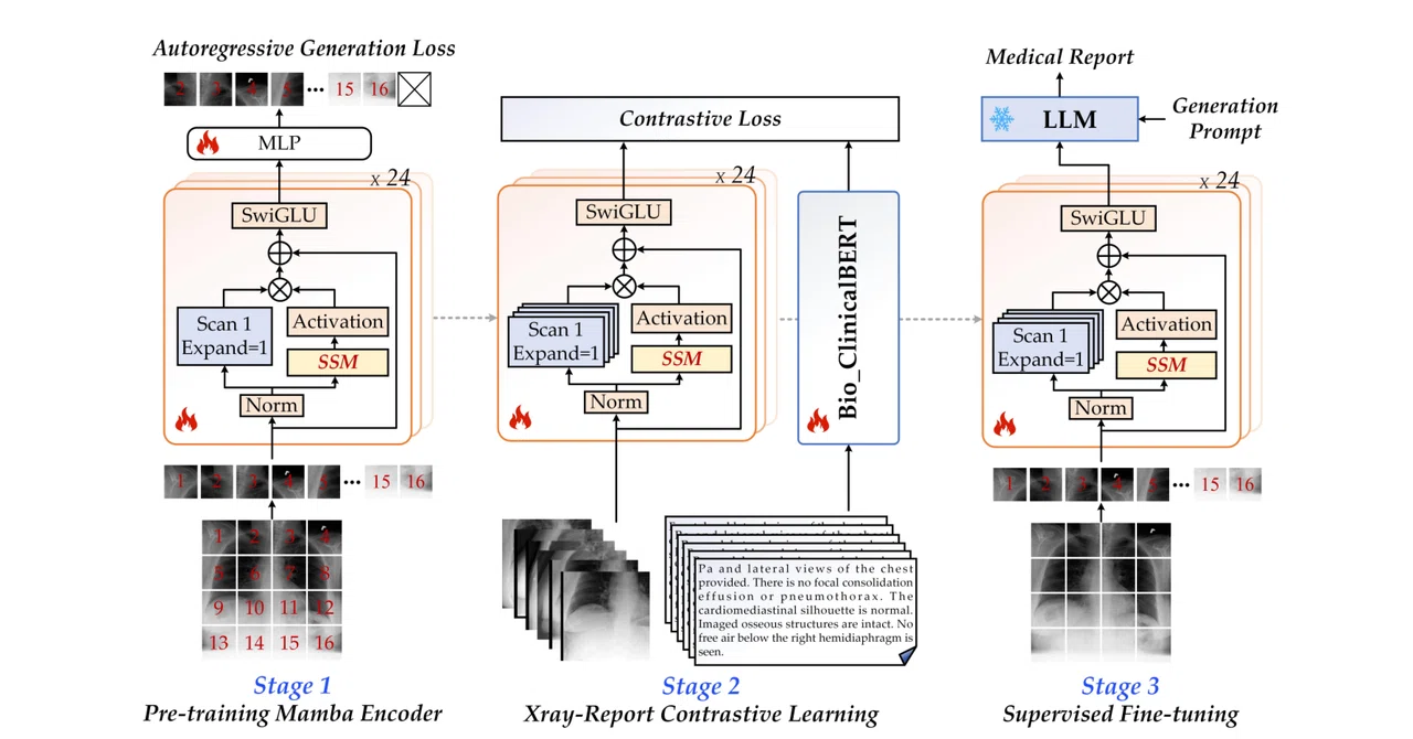 CXPMRG-Bench：CheXpert Plus データセットを用いたX線診断レポート生成の事前学習とベンチマーク評価｜Med@AI