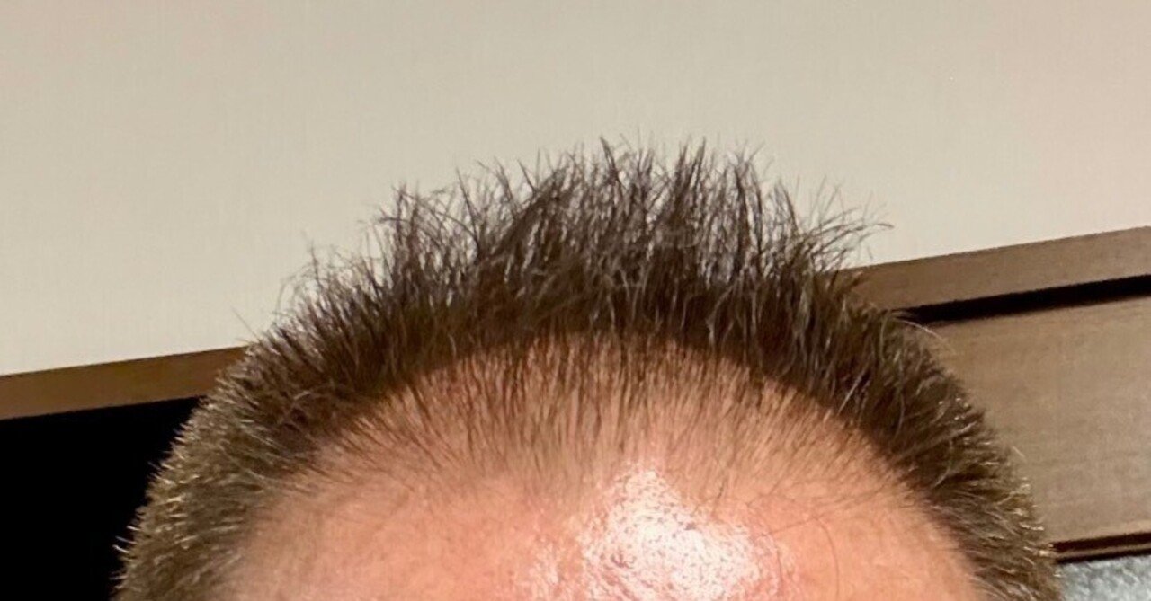 ソフトモヒカンまで20分｜Ty Matsumoto