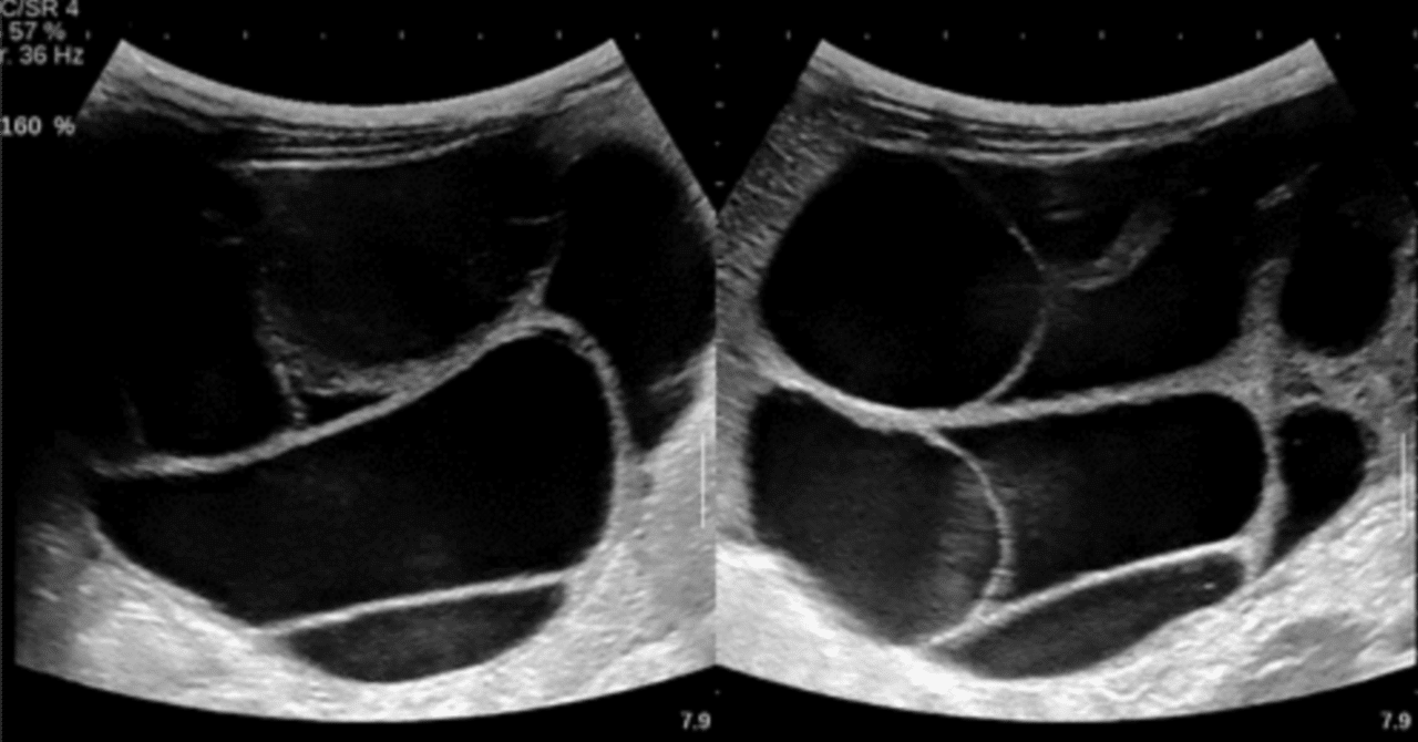Case 308｜Toshihiro Furuta