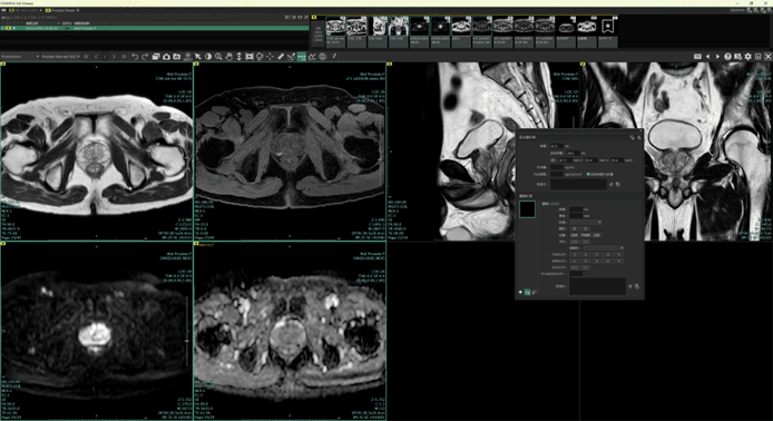 AIで読影がもっと頼もしく。SYNAPSE SAI viewer Ver 2.7、医師の現場を強力に支える新機能を発表｜猫@医療情報技師