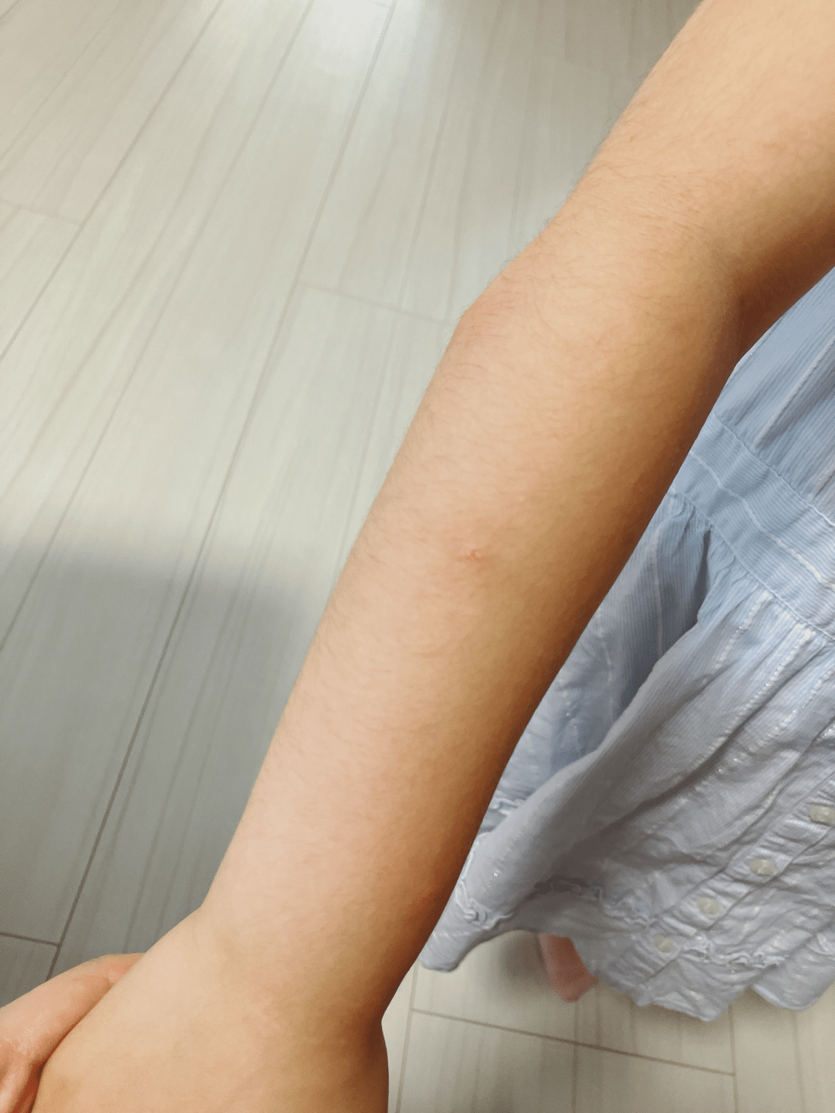 また刺されてる…！虫除けしてもダメな“本当の原因”とは？｜kasaneni_shima