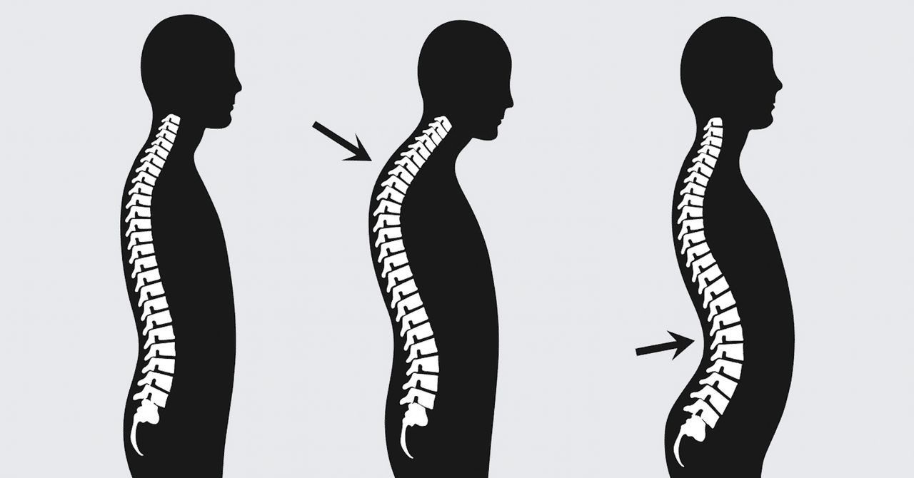 『なぜ腰が反るのか？』 −反り腰の原因と改善策−｜續池均（kintsuzuike）@MTR Method Lab®︎