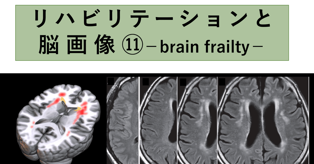 リハビリテーションとbrain frailty｜J. Rehabilitation
