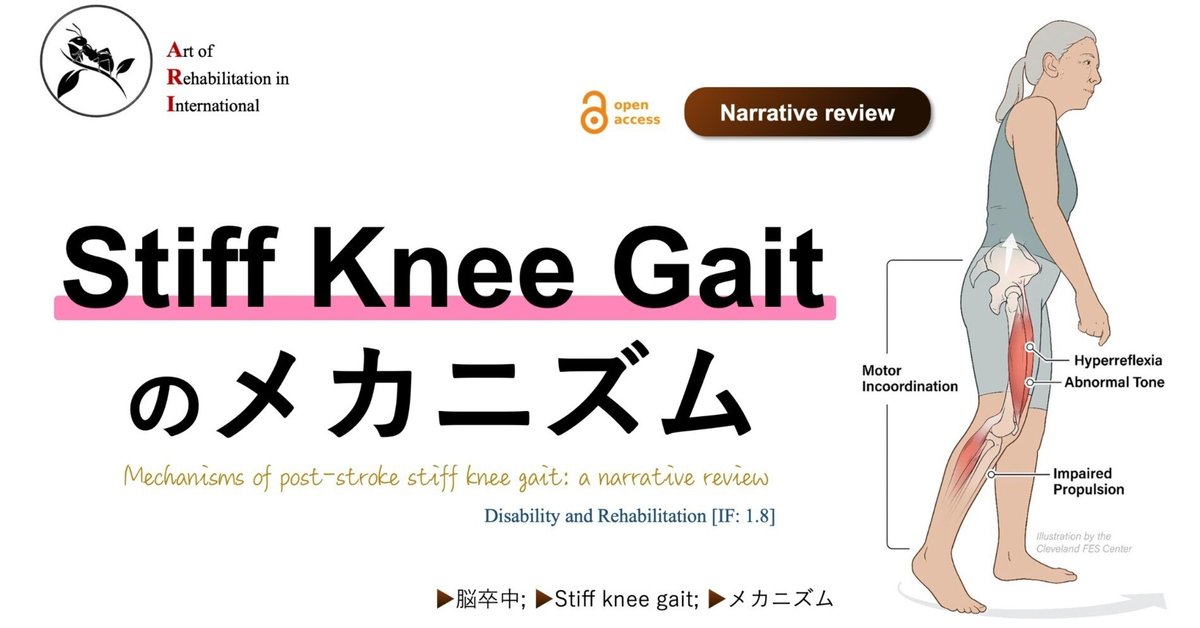 Stiff Knee Gaitのメカニズム｜Super Human | 理学療法士／保健学博士 Ph.D.