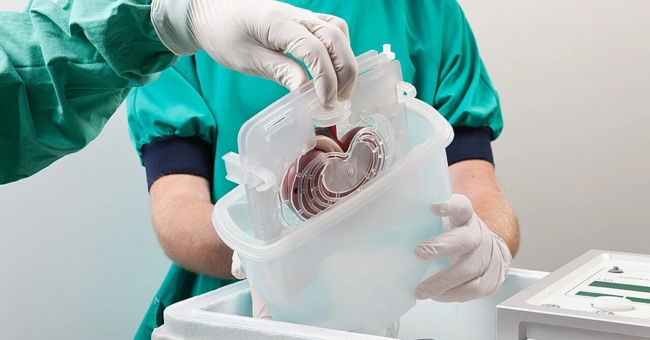 Organ Preservation Solutions市場：サイズ、傾向、および成長予測分析｜cmi1