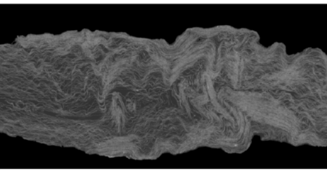 🏺 Kaggle「Vesuvius Challenge – Ink Detection」コンペ概要｜Hachi｜Copilot業務効率化｜AI駆動開発