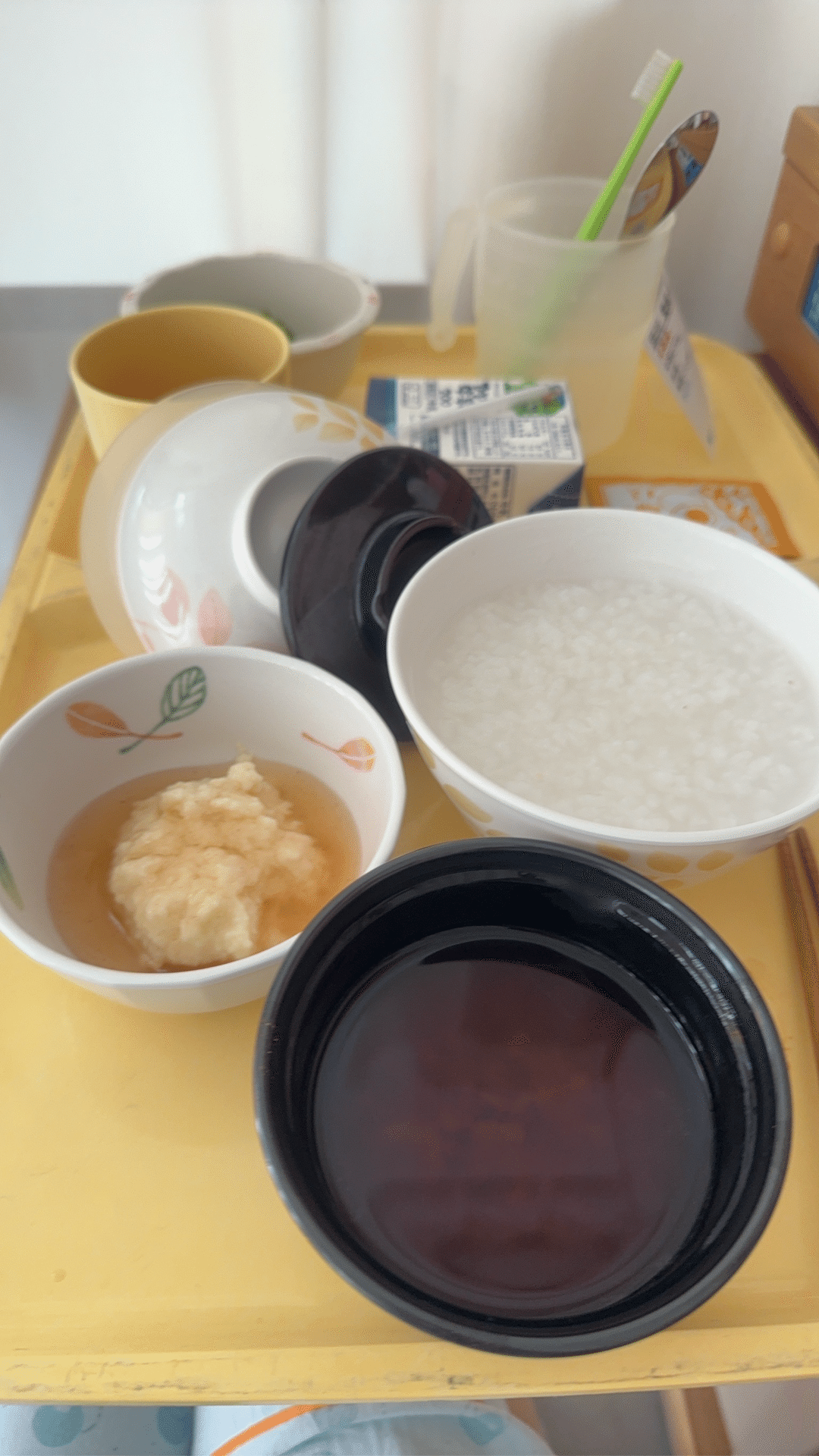 親知らず抜歯、2日目〜米が固形〜｜kawata