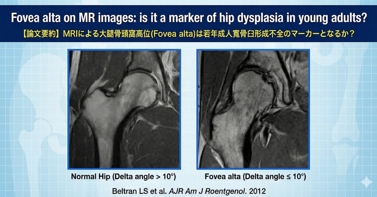 Fovea altaは寛骨臼形成不全のマーカーとなりうるか？ AJR 2012｜骨大工さん見習い