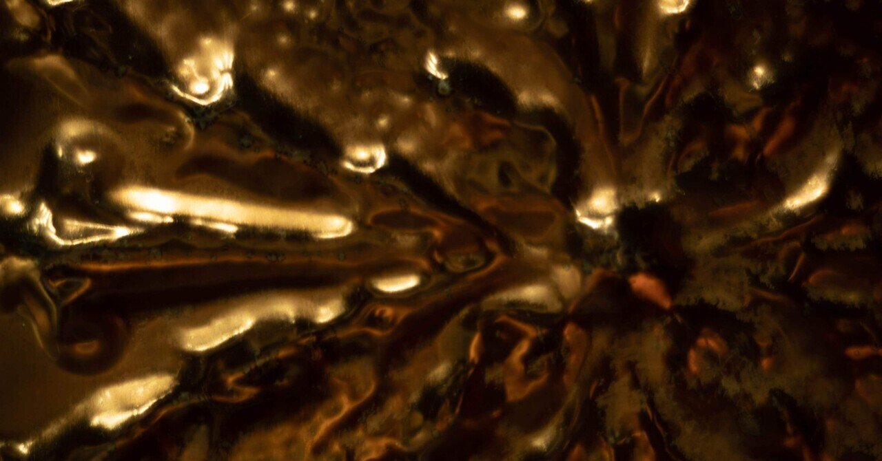 明日、何食べる #251 歯がない日々｜ちゅん子