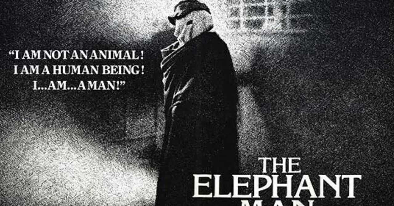Joseph Carey Merrick (the Elephant Man) was sustained throughout his ...