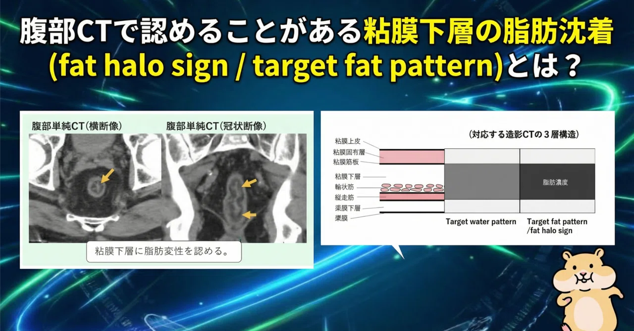 腹部CTで認めることがある粘膜下層の脂肪沈着(fat halo sign / target fat pattern)とは？｜とっとこ画像診断太郎