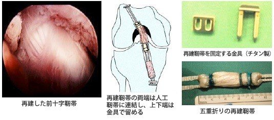前十字靭帯｜Ryuji Motojima