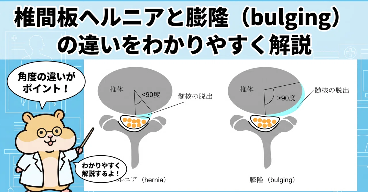 An easy-to-understand explanation of the difference between a herniated ...