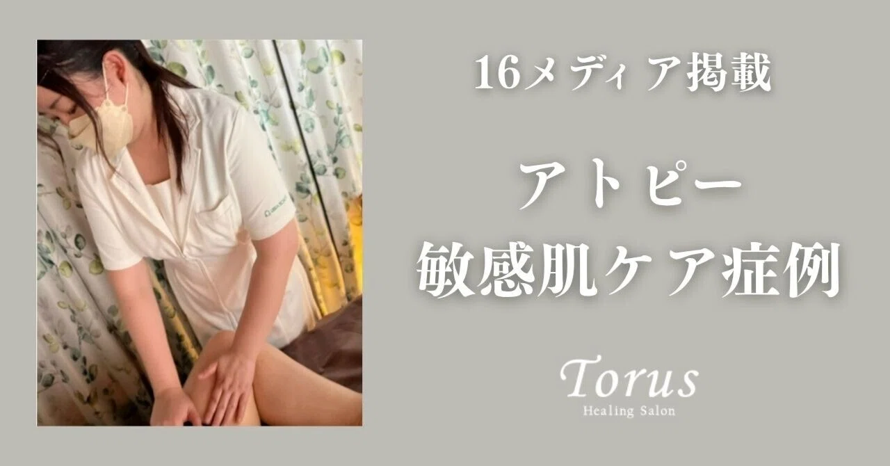 「ずっと悩んでいたアトピー肌が落ち着いた。16メディア掲載の症例」｜【千葉旭】肌も心もうるツヤ上向き トーラス Healing Salon Torus