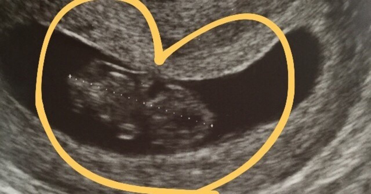 9w4d。大学病院へ初妊婦健診｜にこ天使ママ