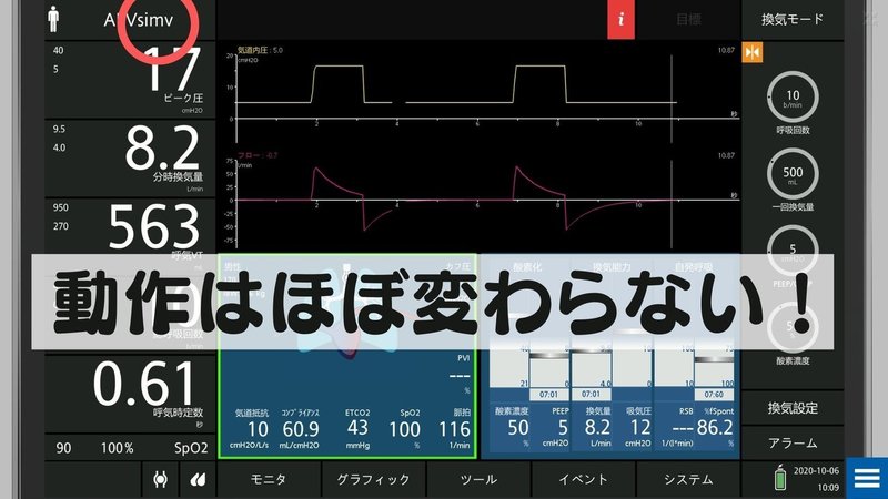 わかるまで解説する人工呼吸器②SIMVってなに？｜ムロ＠ケン