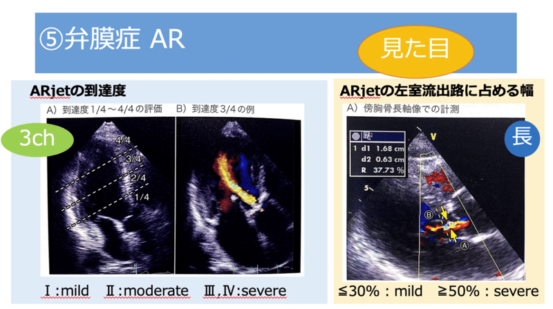 ＃心エコー｜Gajumaruのメディカルワークアウト